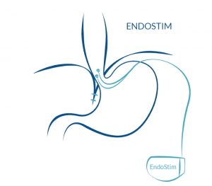 EndoStim – Antireflux-Schrittmacher – antireflux.info